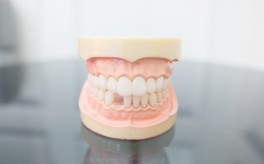 Dent cassée ou manquante | Dr Guillaume Fuchs | Dentiste | Bain-de-Bretagne